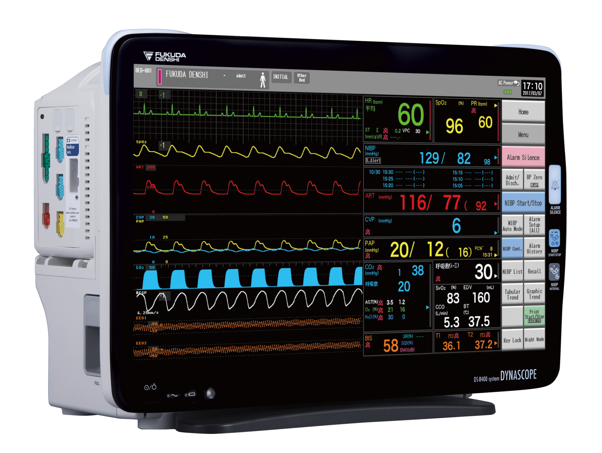 Dynascope DS-8400 Critical Care Monitor | Fukuda Denshi