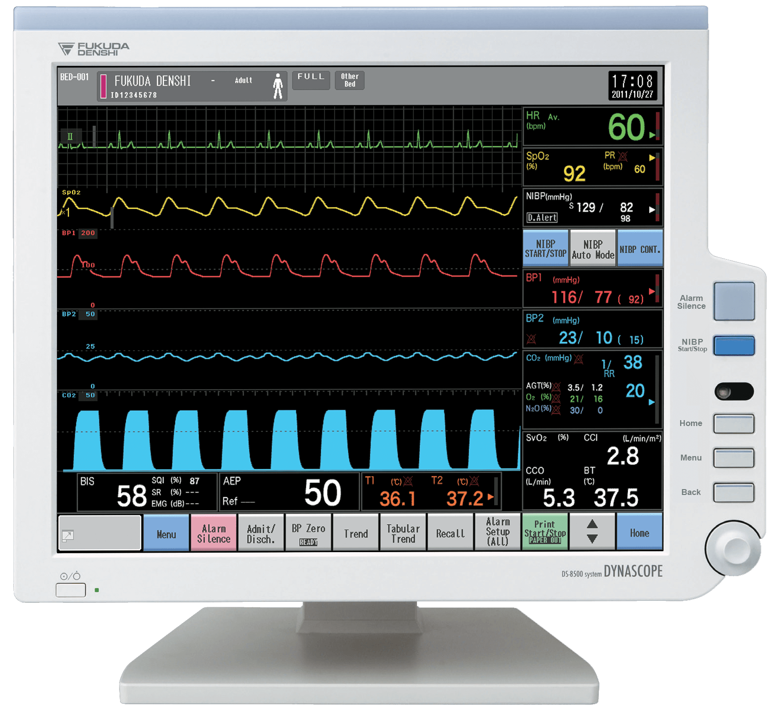 Dynascope DS 8500 Critical Care Monitor Support Fukuda Denshi Dynascope DS 8500 Critical Care Monitor Support Fukuda Denshi