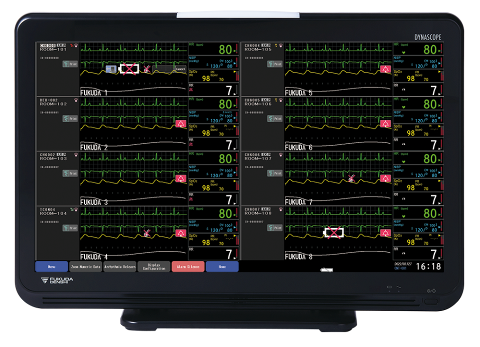 Dynascope BDS-1001 Bedside Monitor | Fukuda Denshi