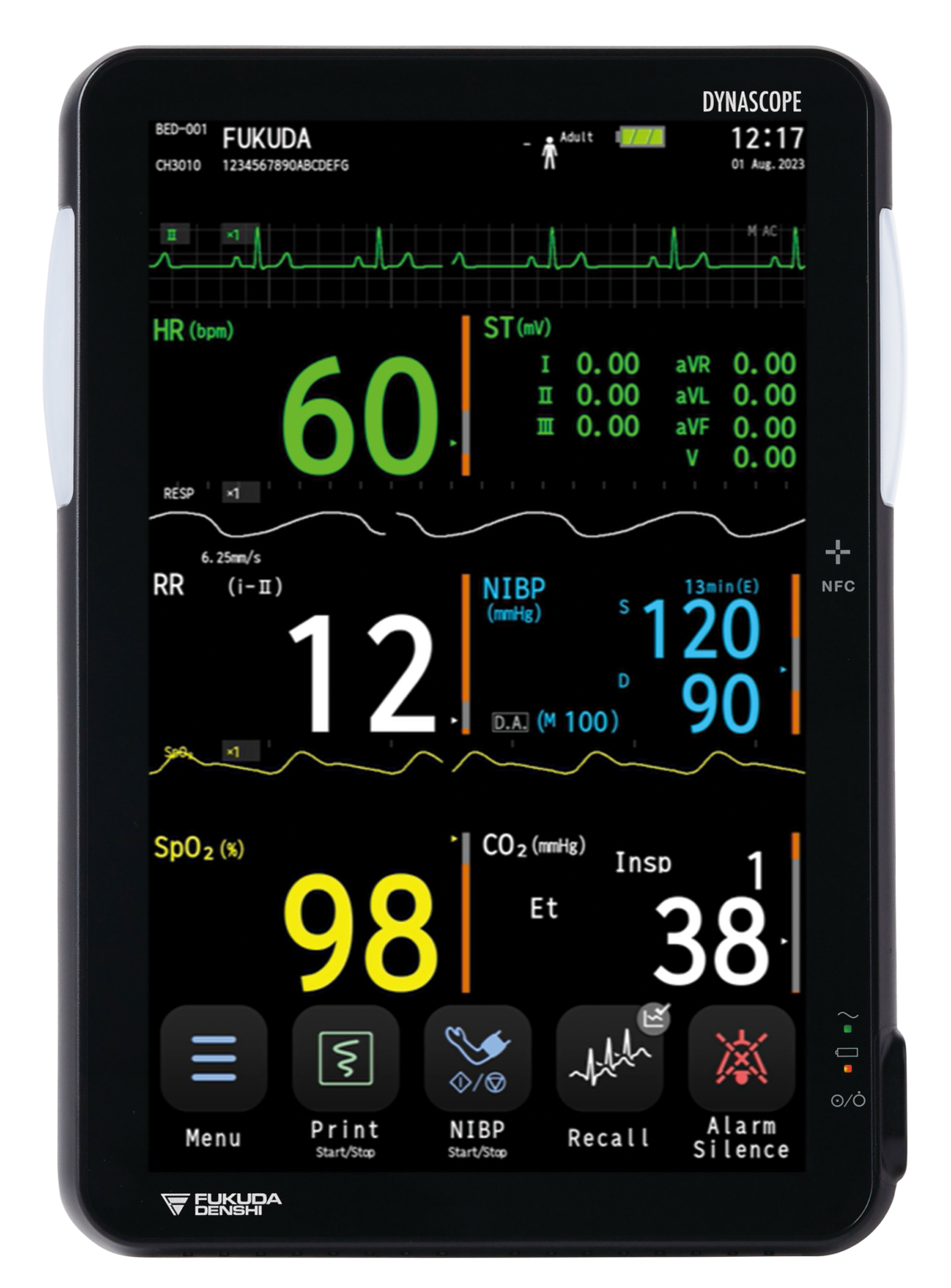 Dynascope BDS-1001 Bedside Monitor | Fukuda Denshi